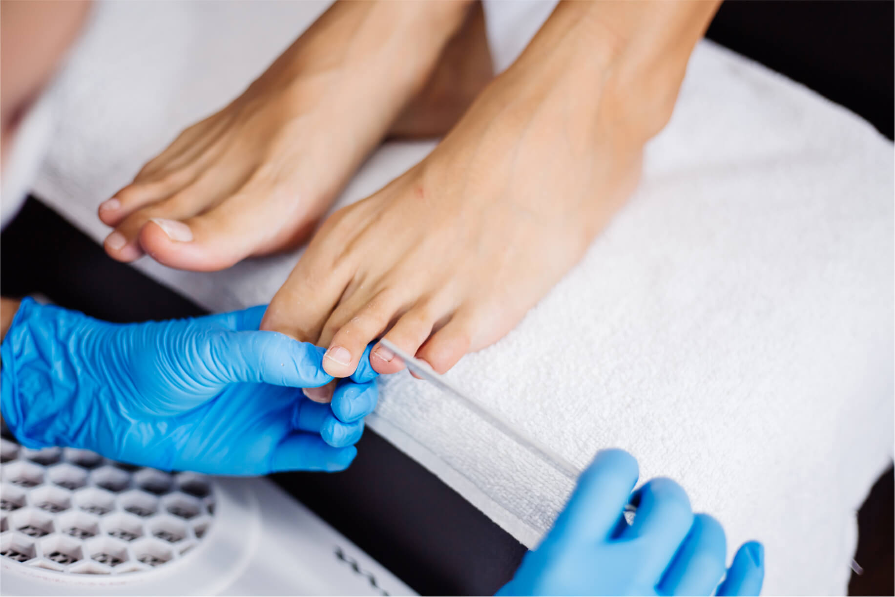 Ingrown toe nails – Market Street Clinic